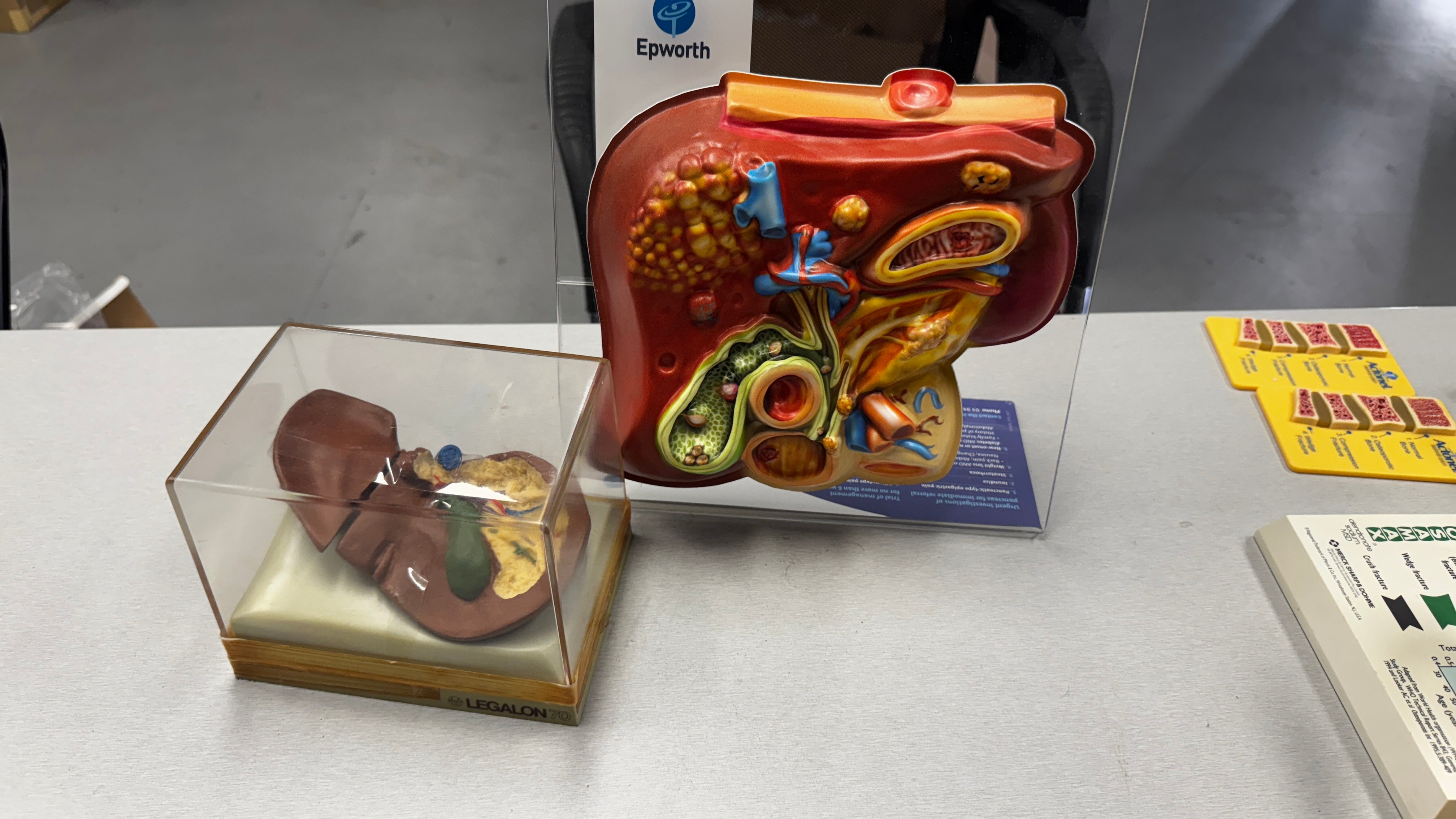 Pancreas - Educational Models – Medical Pantry